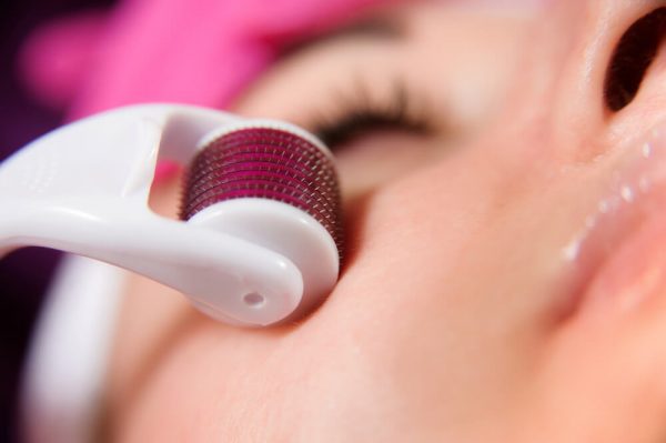 How to Use a Derma Roller for Loose Skin • Voupre